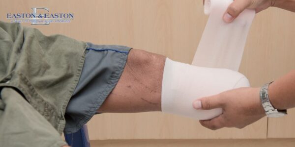Orange County Amputation Injury Attorney & Law Firm
