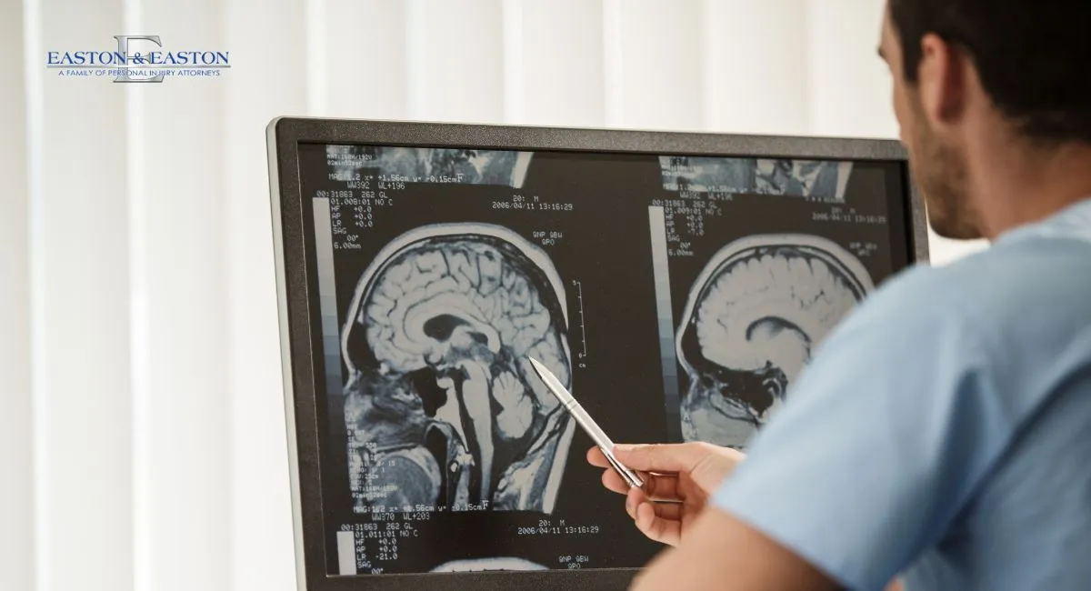 Summerlin Traumatic Brain Injury Lawyer - TBI Attorney NV